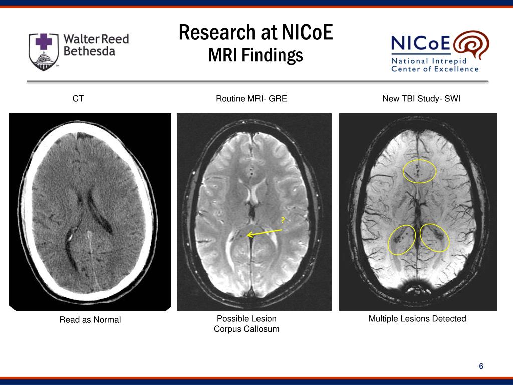PPT - Complementary AND ALTERNATIVE THERAPIES NICoE’ s Approach to ...