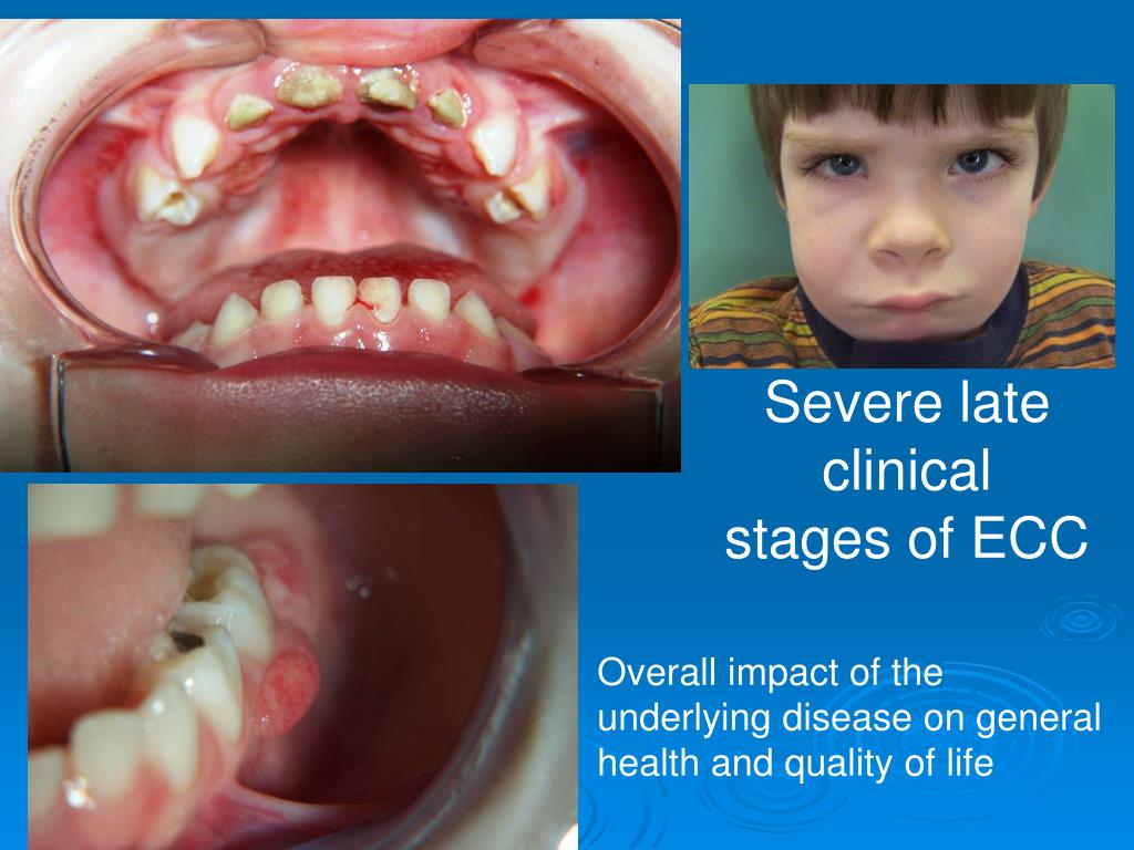 PPT - Top ten facts a pediatric dentist would like pediatricians to ...