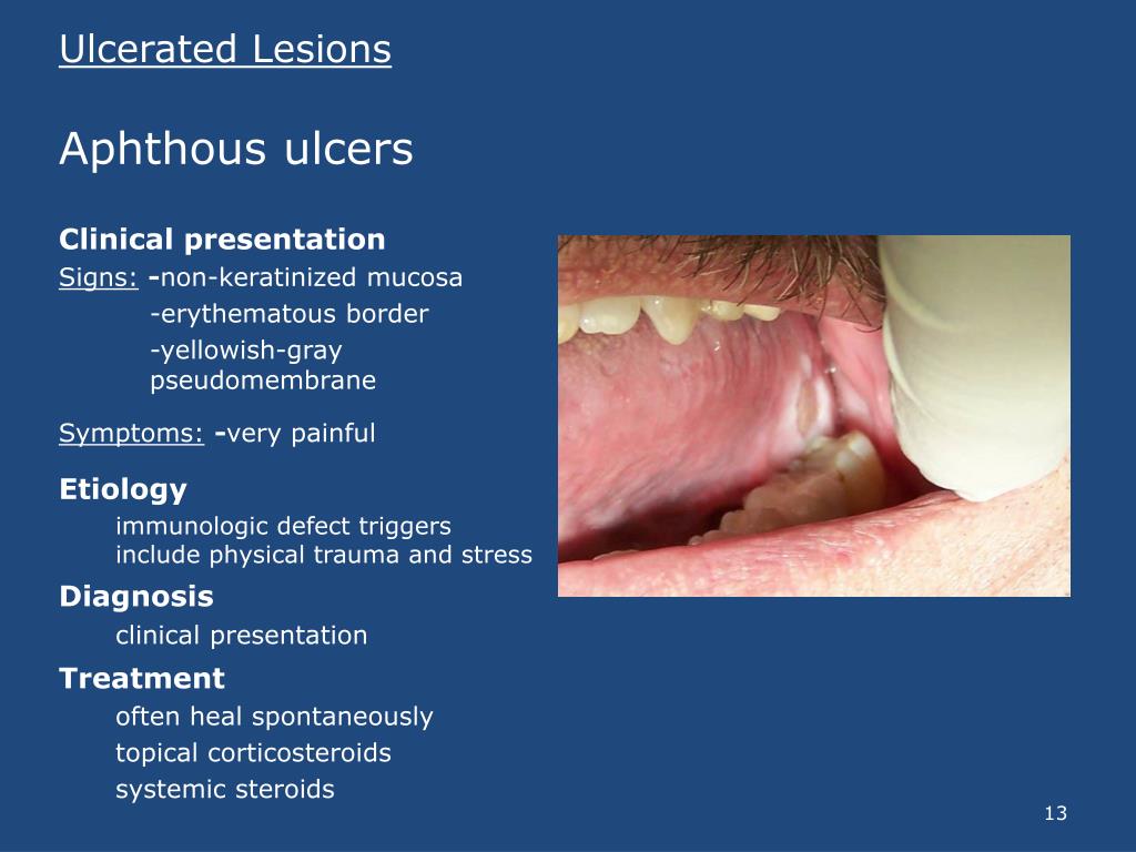 PPT - Guide to Oral Health Care for People Living with HIV/AIDS ...