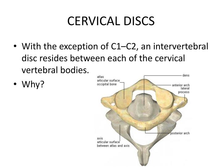 PPT - ANTERIOR CERVICAL DISCECTOMY WITH FUSION (ACDF) PowerPoint ...