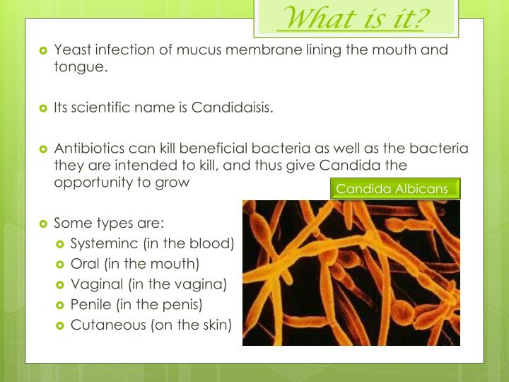 PPT - Thrush PowerPoint Presentation - ID:1603813