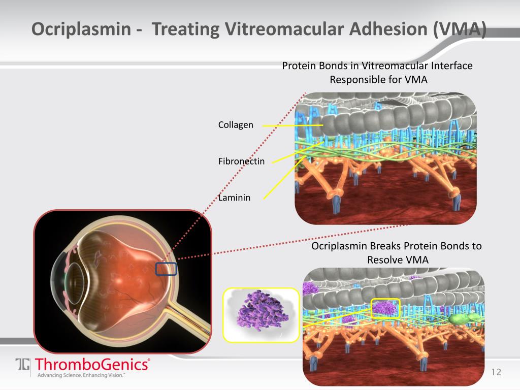 PPT - ThromboGenics – delivering innovative ophthalmic medicines ...