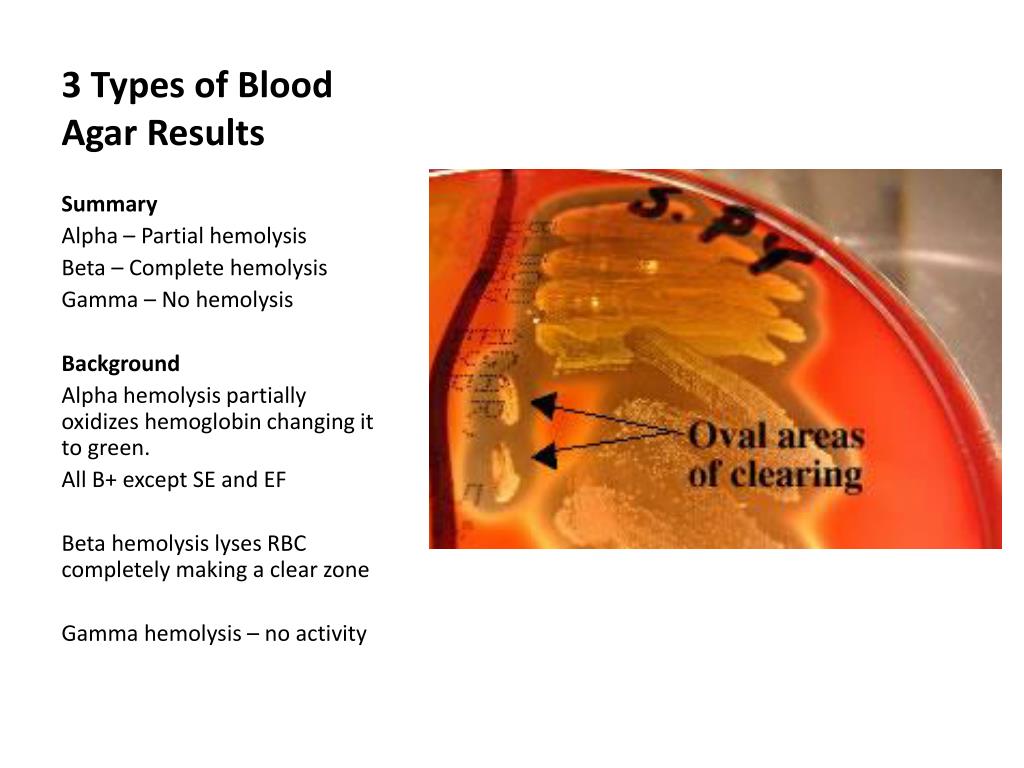 PPT - Summary of Biochemical Tests in Microbiology PowerPoint ... PPT - Summary of Biochemical Tests in Microbiology PowerPoint ...