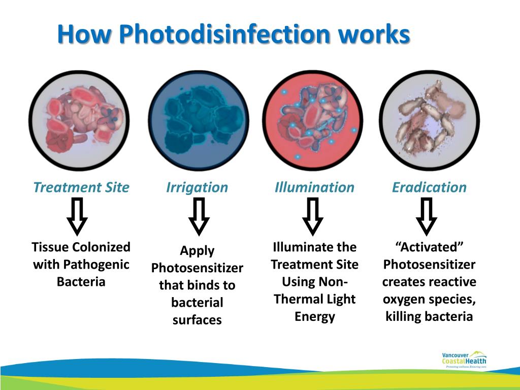 PPT - Immediate Pre-operative Decolonization Therapy Reduces Surgical ...