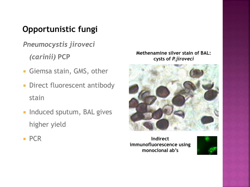 PPT - THE ROLE OF THE MICROBIOLOGY LABORATORY IN THE DIAGNOSIS OF ...