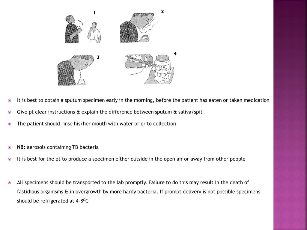 PPT - THE ROLE OF THE MICROBIOLOGY LABORATORY IN THE DIAGNOSIS OF ...