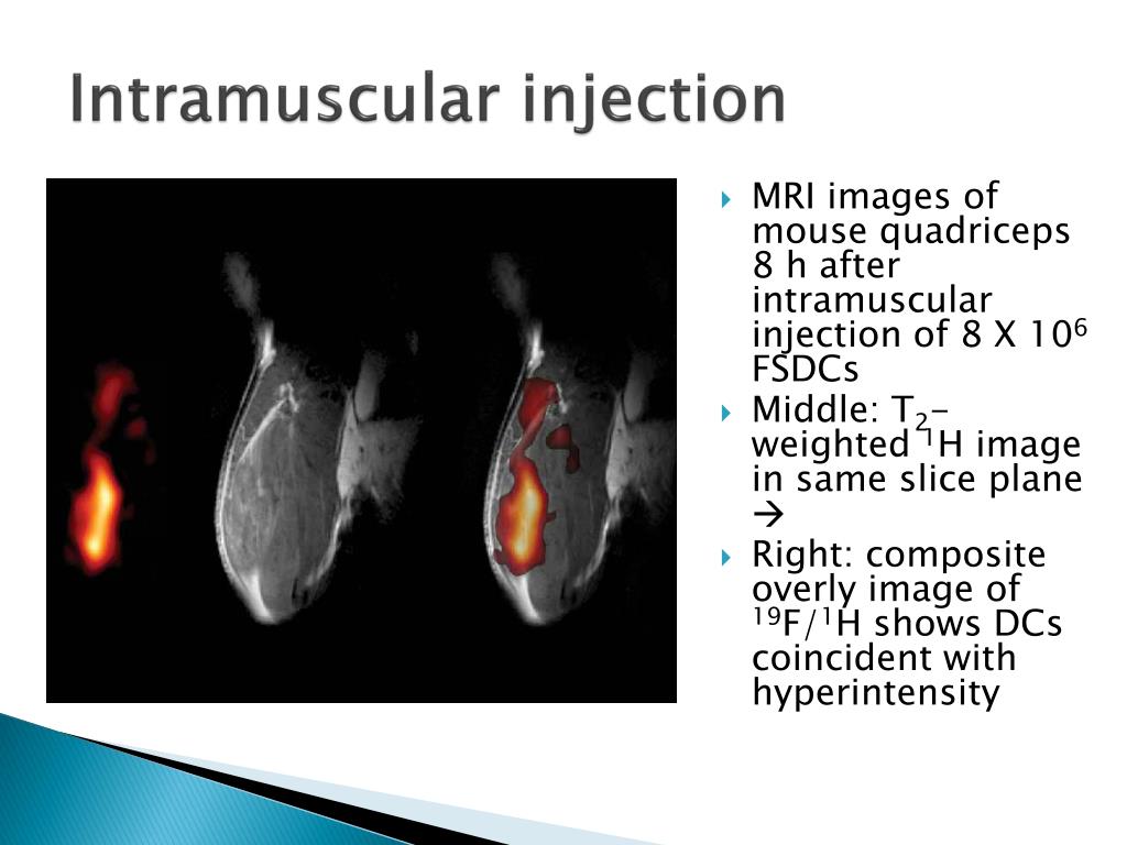 PPT - In vivo imaging platform for tracking immunotherapeutic cells ...