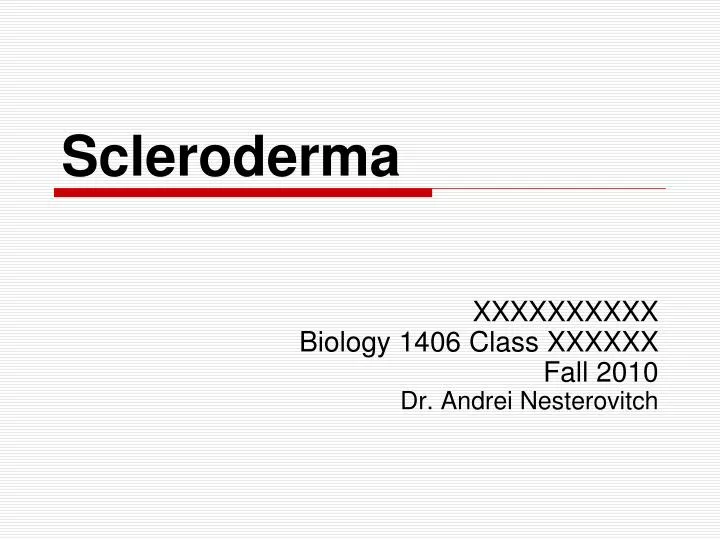 PPT - Scleroderma PowerPoint Presentation, free download - ID:1615064