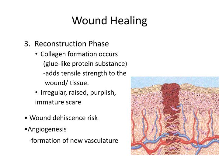 PPT - Surgical Wound Care PowerPoint Presentation - ID:1615782