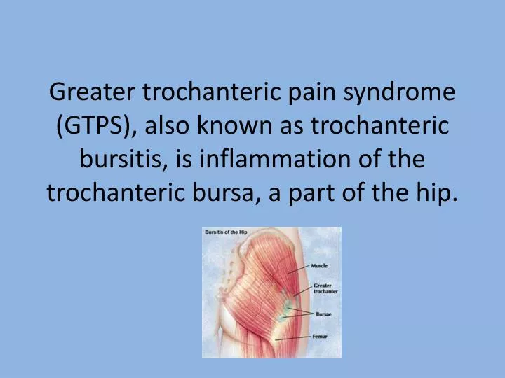 PPT - Greater trochanteric pain syndrome (GTPS), also known as ...