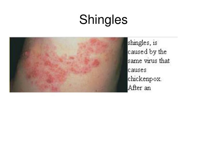 PPT - Dental Pathology and Microbiology PowerPoint Presentation - ID ...