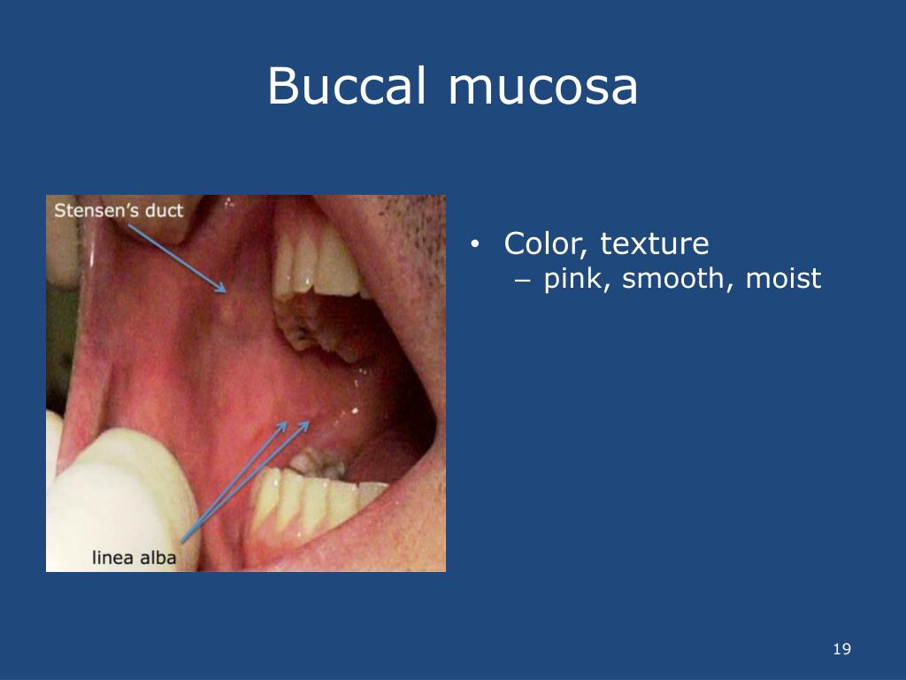 PPT - Guide to Oral Health Care for People Living with HIV/AIDS ...