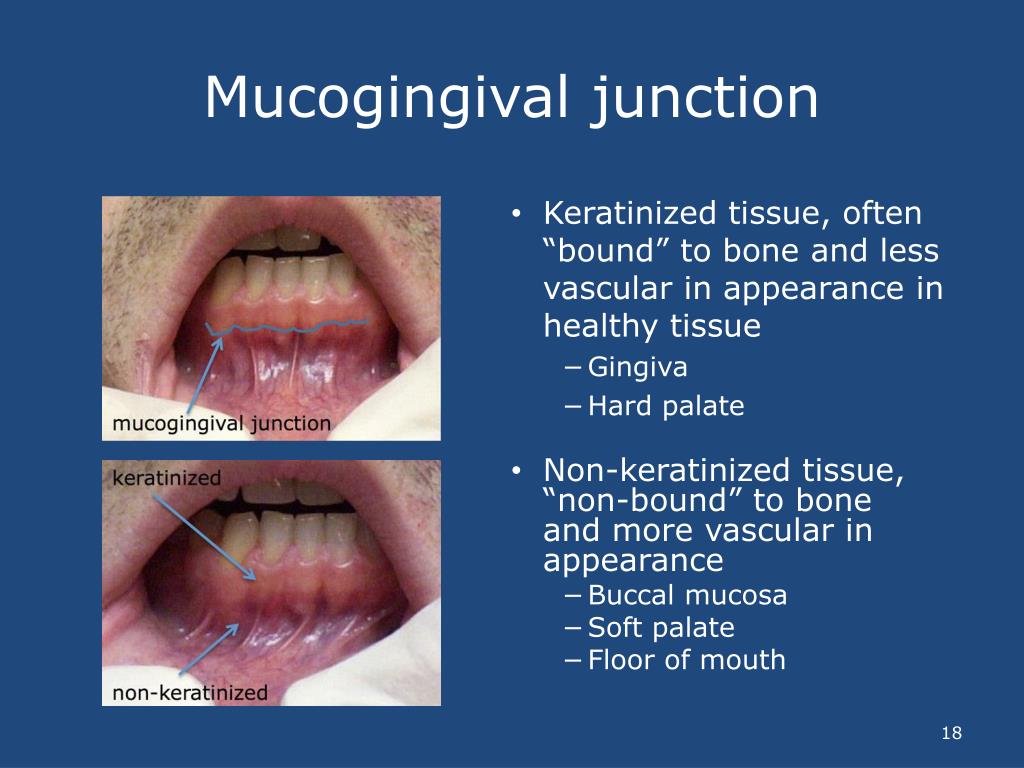 PPT - Guide to Oral Health Care for People Living with HIV/AIDS ...