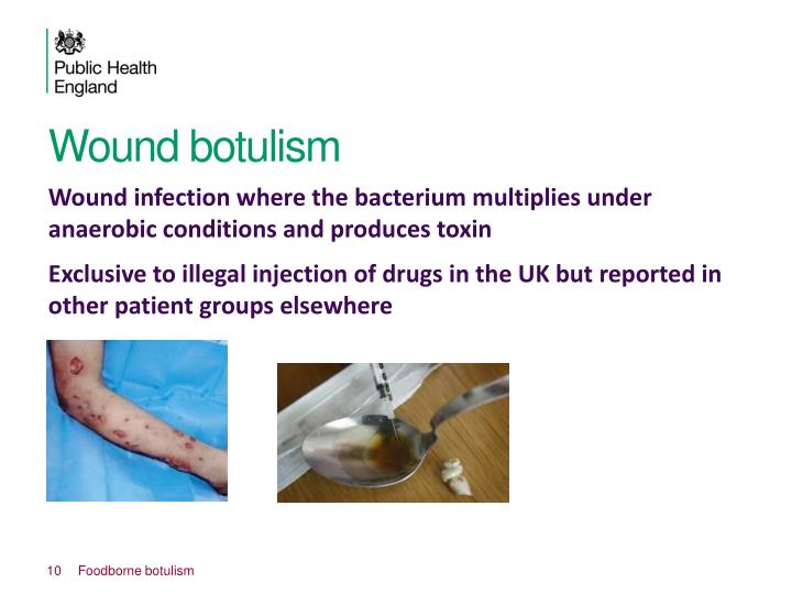 PPT - Foodborne Botulism or… Please don’t pass the olives! Unusual ...