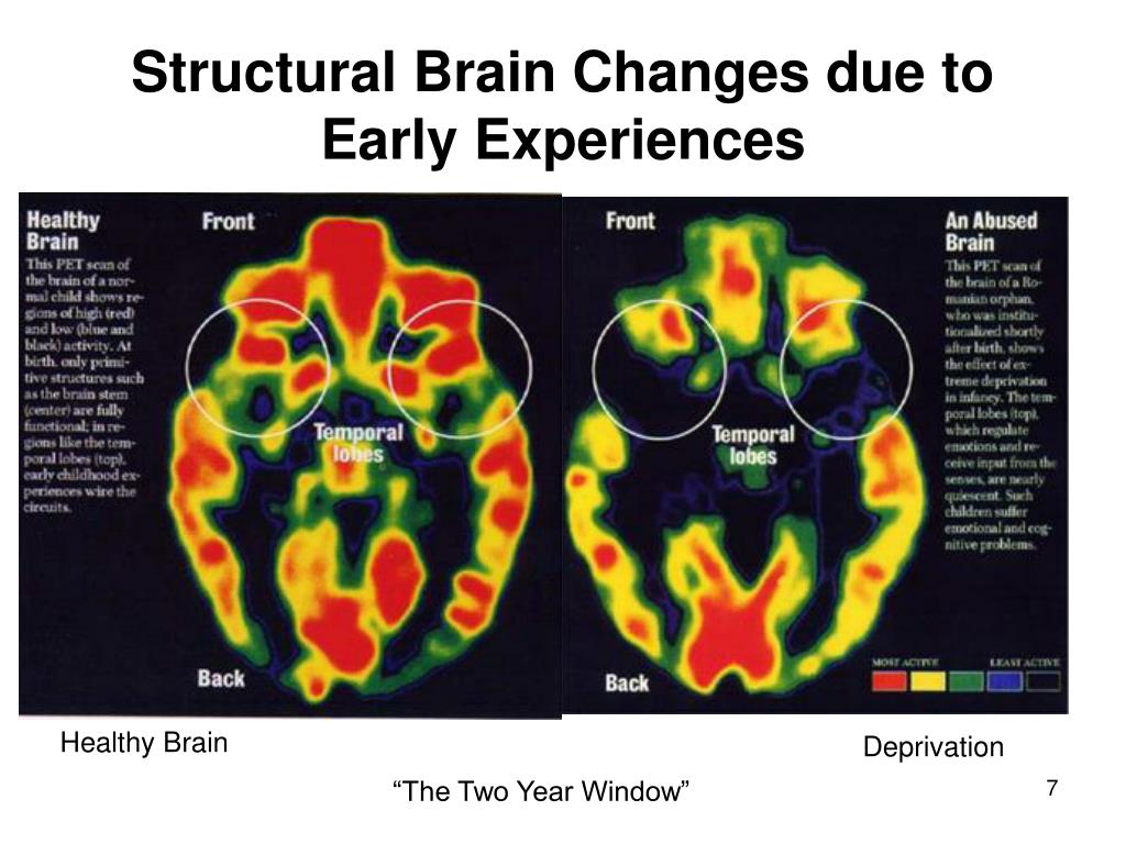 PPT - Family Support in Early Childhood PowerPoint Presentation, free ...