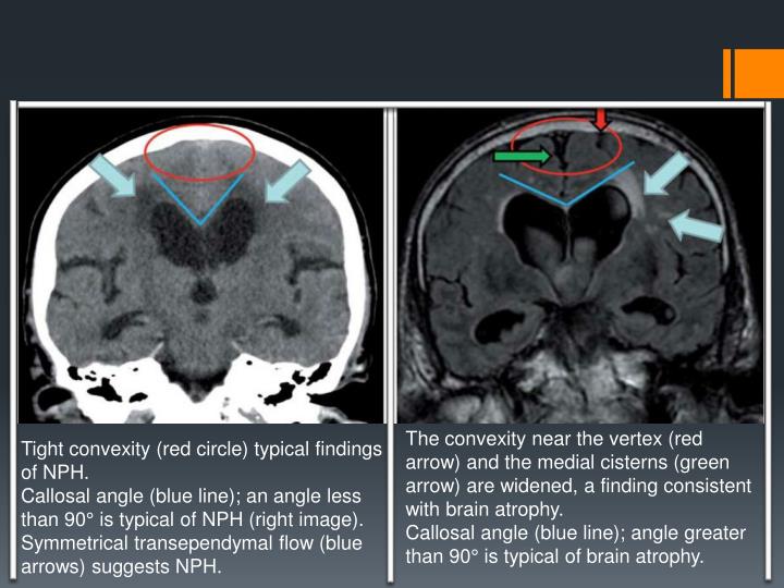 PPT - Walid Radwan PowerPoint Presentation - ID:1634165