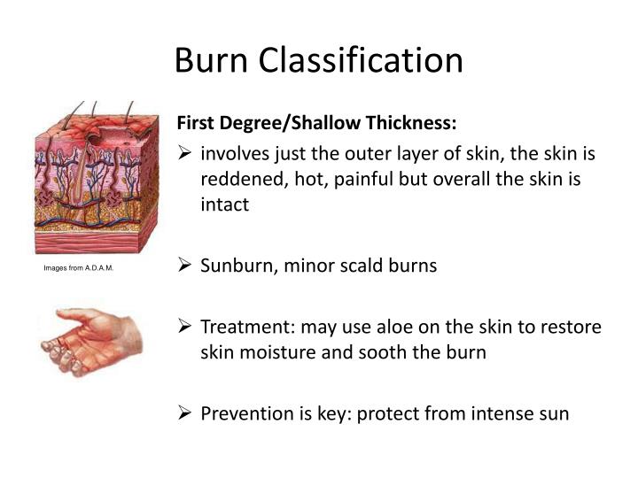 PPT - Soft Tissue Injury PowerPoint Presentation - ID:1634436