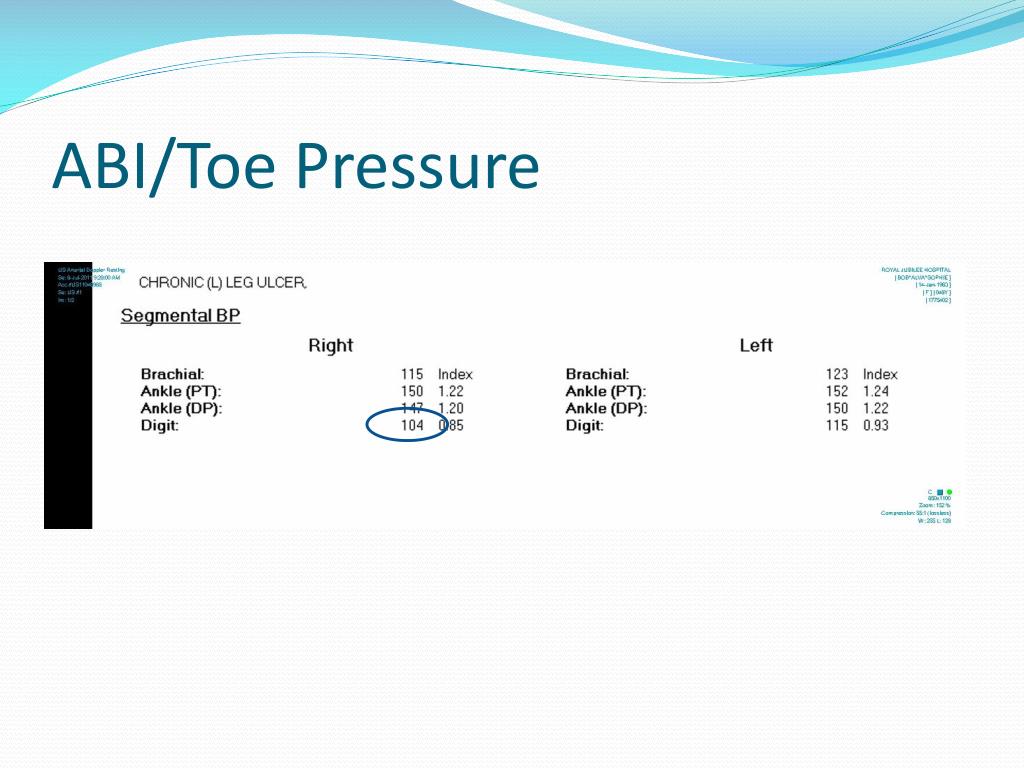 PPT - Foot and Leg Wound Management: Medical Issues PowerPoint ...