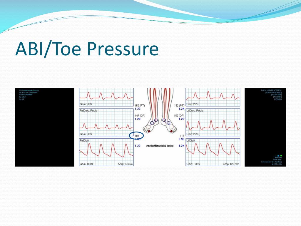 PPT - Foot and Leg Wound Management: Medical Issues PowerPoint ...