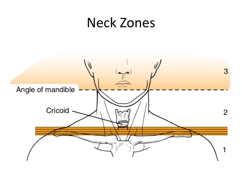 PPT - Cummings Ch 115: Penetrating and Blunt Trauma to the Neck ...