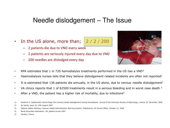 PPT - Needle dislodgement – The Issue PowerPoint Presentation - ID:1666985
