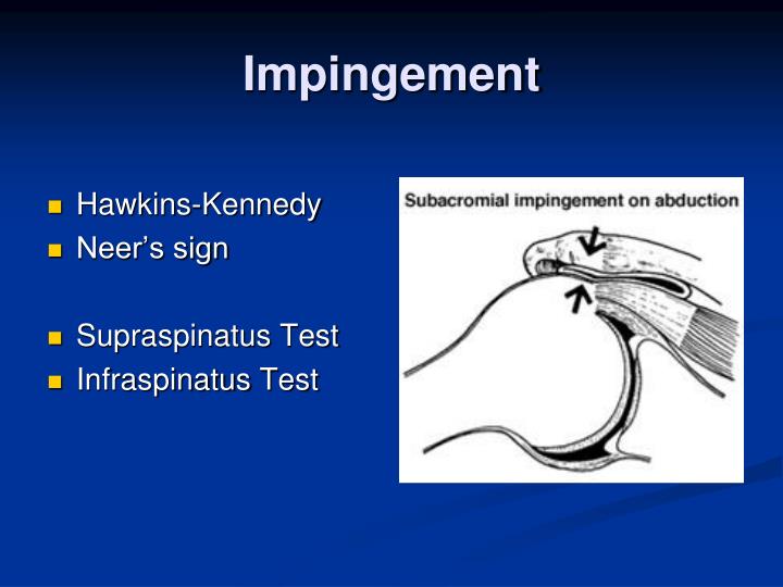 PPT - Orthopedic Special Tests for the Shoulder PowerPoint Presentation ...