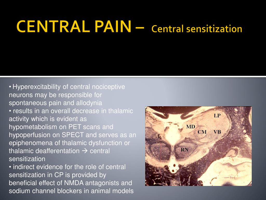 PPT - CENTRALNA BOLEČINA – PATOFIZIOLOGIJA IN TERAPIJA CENTRAL PAIN ...
