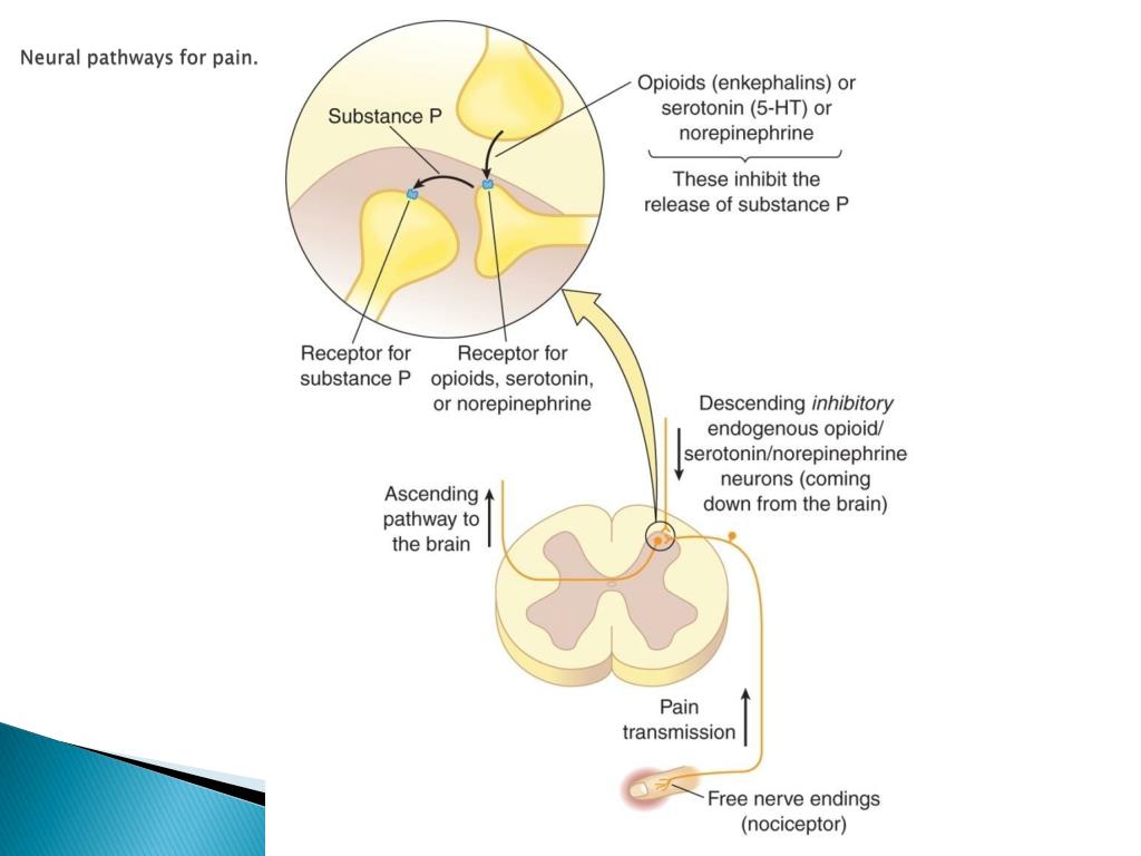 PPT - PAIN MANAGEMENT Opioids, NSAIDs, Migraine drugs PowerPoint ...
