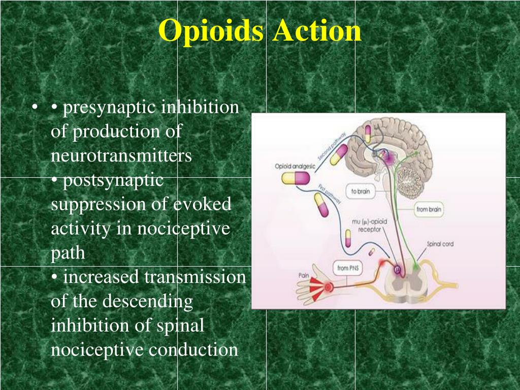 PPT - Prescribing Pain Medications A Scientific Approach? PowerPoint ...
