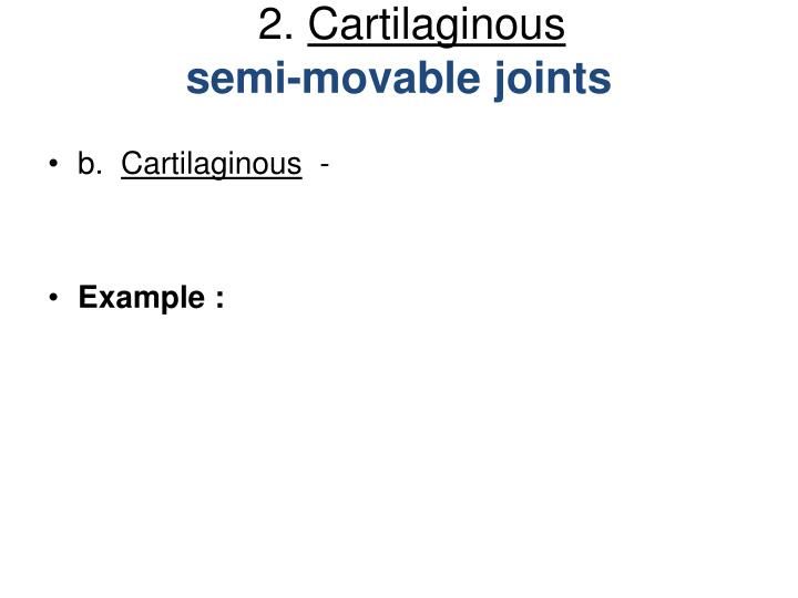 PPT - Joints of the Human Body PowerPoint Presentation - ID:1701928