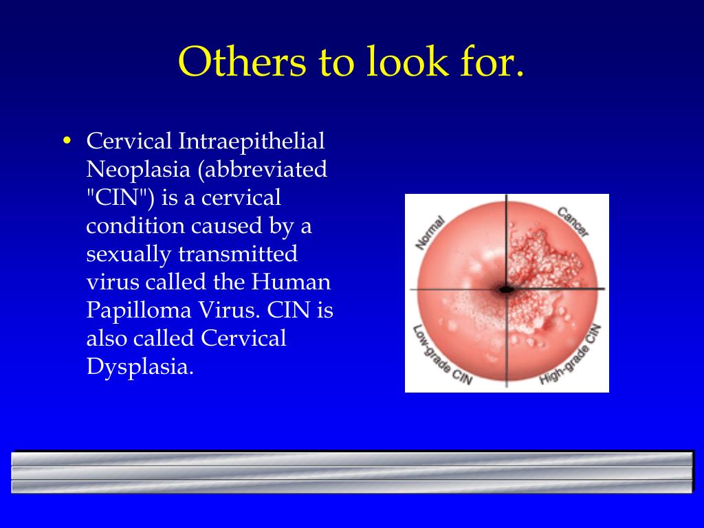 PPT - Colposcopy PowerPoint Presentation, free download - ID:1703513 PPT - Colposcopy PowerPoint Presentation, free download - ID:1703513