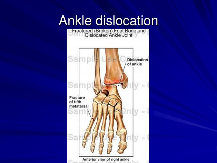 PPT - Foot, Ankle, and Lower Leg PowerPoint Presentation - ID:1703925