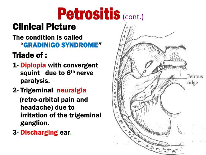 PPT - Department of Otorhinolaryngology PowerPoint Presentation - ID ...