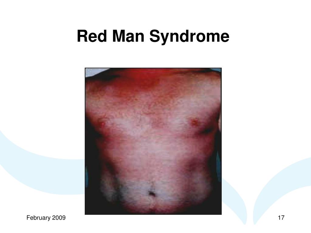 PPT - Pharmaceutical Aspects of IV Medicine Administration PowerPoint ...