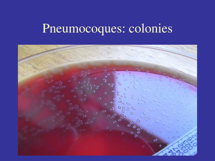 PPT - Streptocoques, pneumocoque, entérocoques PowerPoint Presentation ...