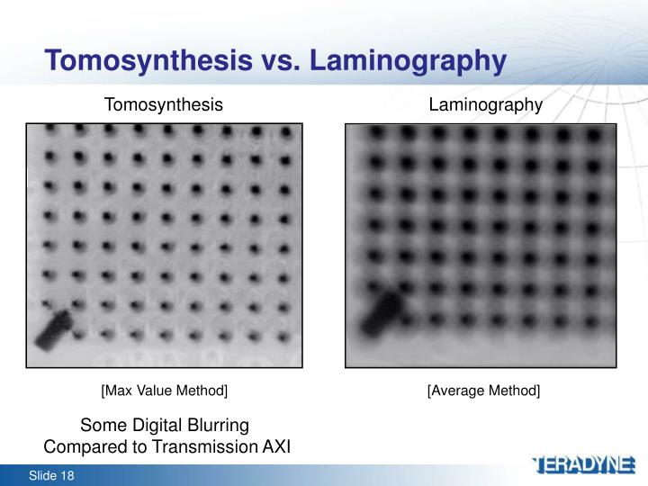 PPT - “Understanding AXI Acquisition Techniques and Image Quality ...