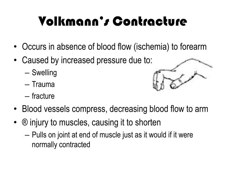 Volkmann's Contracture