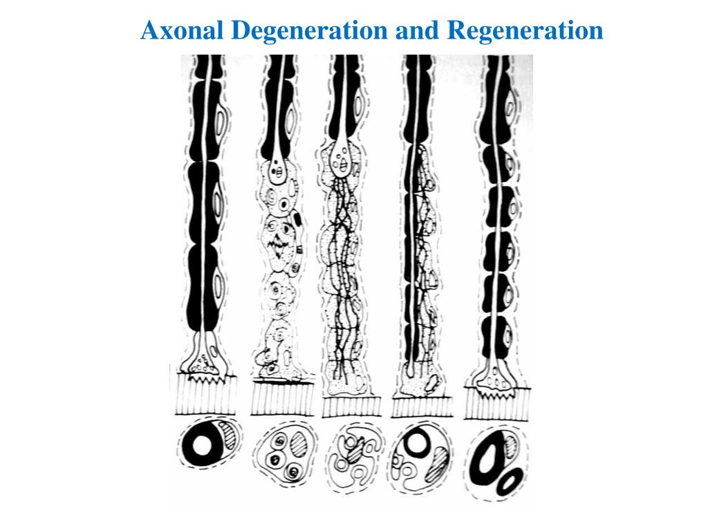 PPT - Clinical Aspects of Peripheral Nerve and Muscle Disease ...