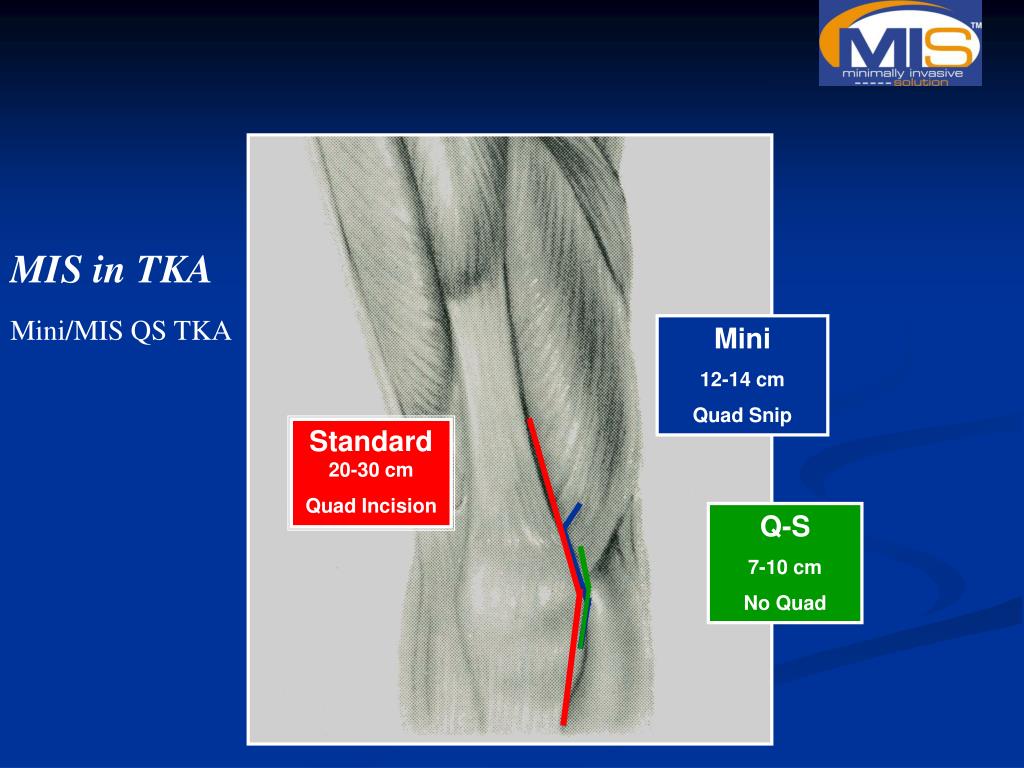 PPT - Hip and Arthritis: Treatment Alternatives To Remain Active ...