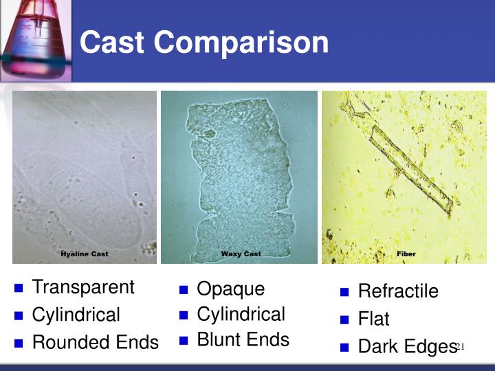 PPT - Urine Sediment Identification PowerPoint Presentation - ID:1719503