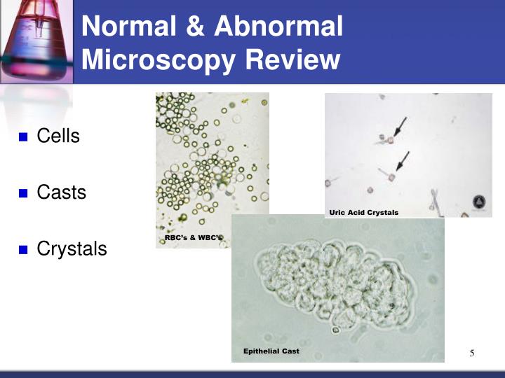 PPT - Urine Sediment Identification PowerPoint Presentation - ID:1719503