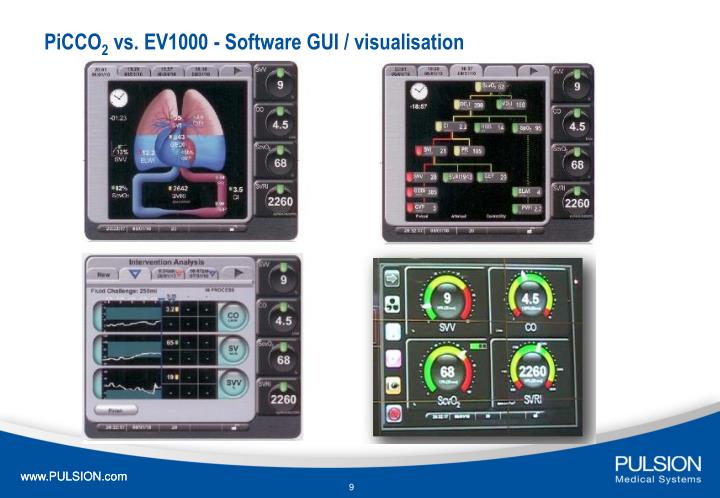 PPT - PULSION Medical Systems SE PowerPoint Presentation - ID:1720193