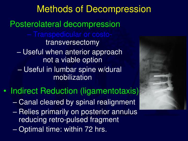 PPT - Surgical Treatment of Fractures and Dislocations of the Thoracic ...