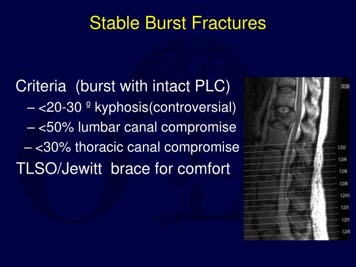 PPT - Surgical Treatment of Fractures and Dislocations of the Thoracic ...