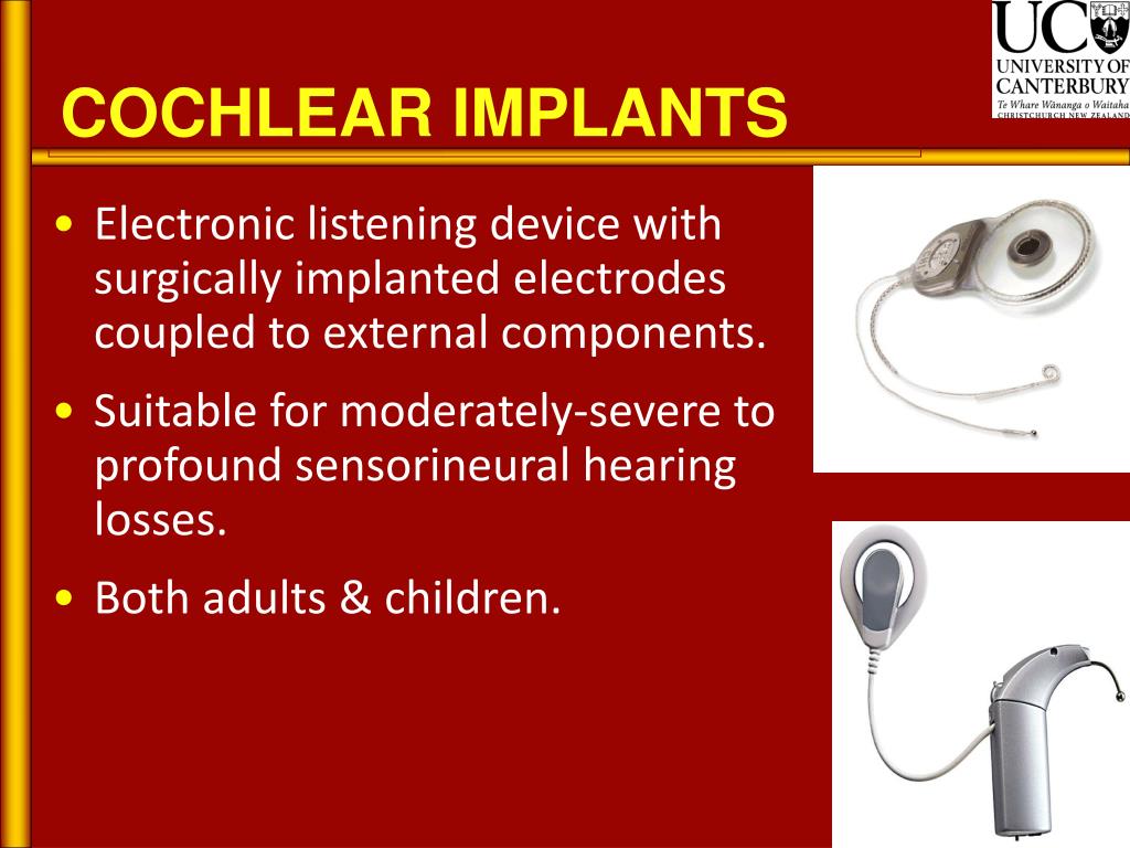 PPT - The Sound of Music, As Reported By Adult Cochlear Implant Users ...