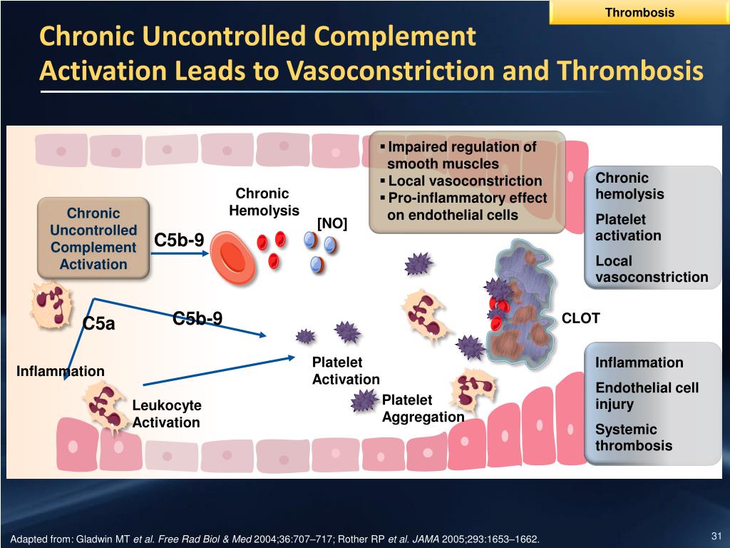 PPT - Advances in Paroxysmal Nocturnal Hemoglobinuria (PNH) PowerPoint ...