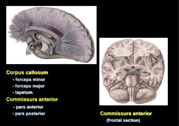 PPT - Telencephalon PowerPoint Presentation - ID:1726108