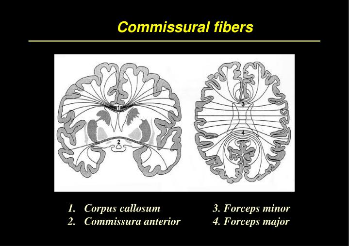 PPT - Telencephalon PowerPoint Presentation - ID:1726108