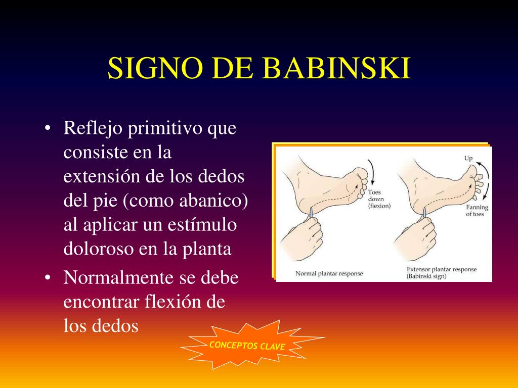 PPT - FASCÍCULOS CORTICOESPINALES Y CORTICONUCLEARES PowerPoint ...