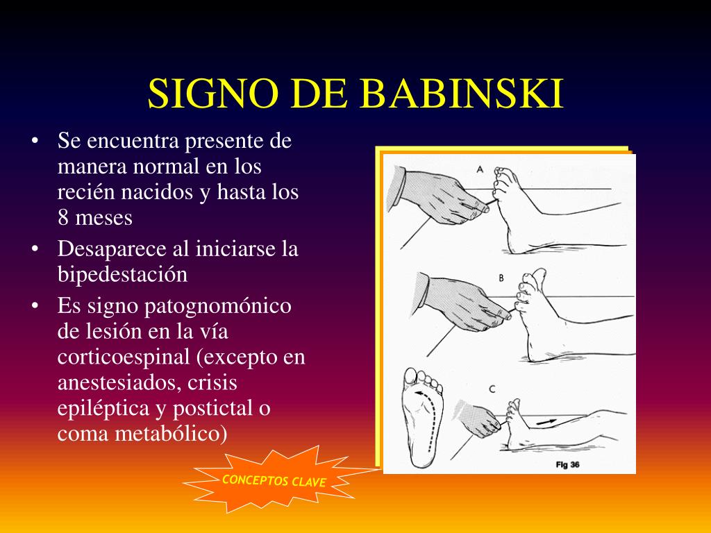 PPT - FASCÍCULOS CORTICOESPINALES Y CORTICONUCLEARES PowerPoint ...